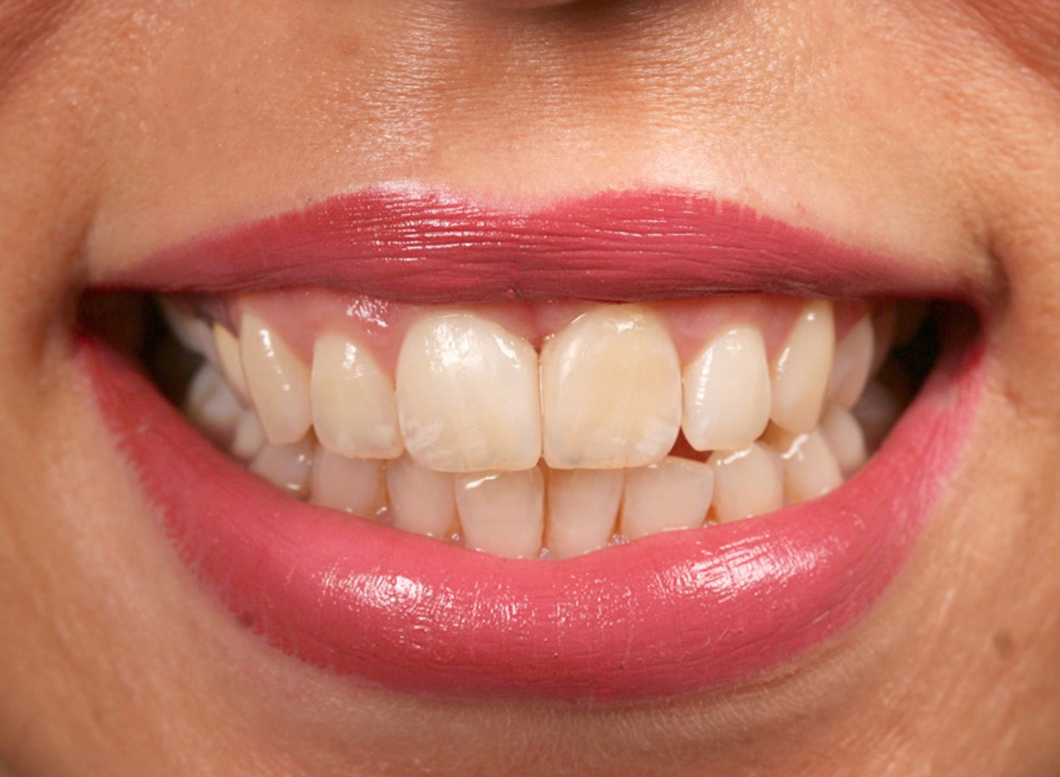 Überzeugende Leistungen - Grau Dentaltechnik Ulm