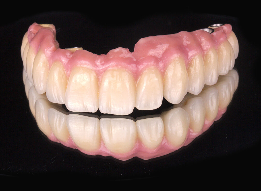 Überzeugende Leistungen - Grau Dentaltechnik Ulm